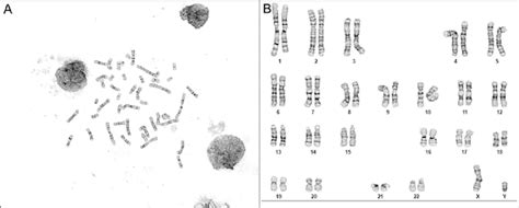 A Metaphase Nucleus And Corresponding Karyogram A A Metaphase