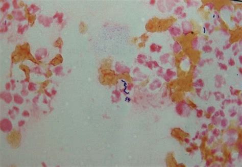 Bacillus Clostridium Listeria Flashcards Quizlet