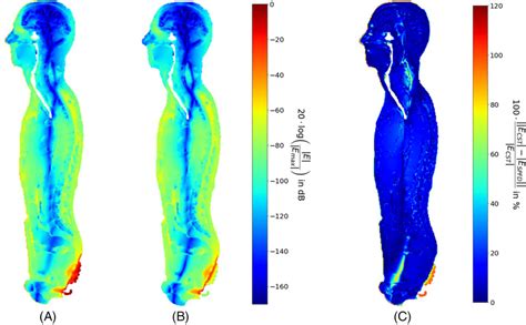 Median Plane Of The Duke” Body Model 2 × 2 × 2 Mm³ Voxel Resolution Download Scientific