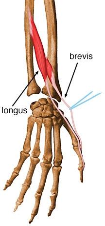 Extensor Pollicis Longus Anatomy Orthobullets
