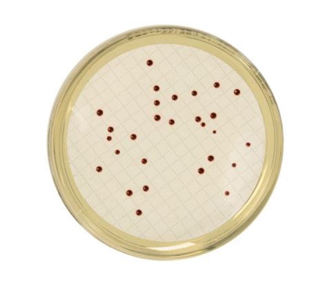 Slanetz And Bartley Agar Biokar Diagnostics