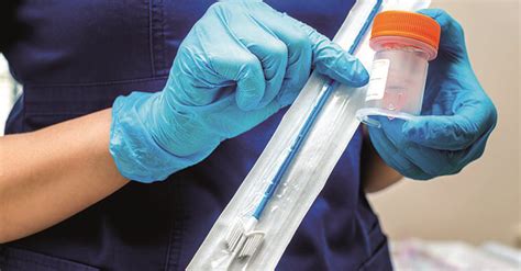 Tackle Health Inequalities To Improve Cervical Screening Uptake