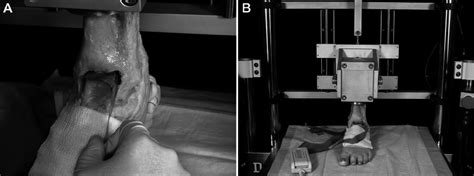 The Experimental Setup A The Tekscan Sensor Is Pulled Into The Ankle Download Scientific