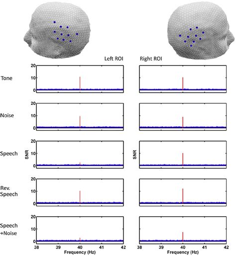 Figure From Semantic And Acoustic Analysis Of Speech By Functional Networks With Distinct Time