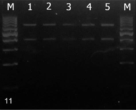 Restriction Fragment Length Polymorphism Analysis On F Gene Fragments Download Scientific