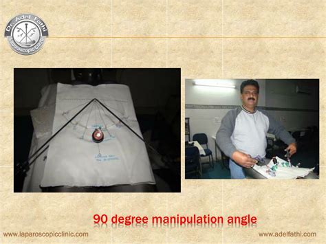 Ppt Ergonomics Of Laparoscopic Surgery Powerpoint Presentation Free Download Id 2121878