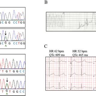 Figure A Genetic Analysis And ECG Records A Upper Two Panels The Download Scientific