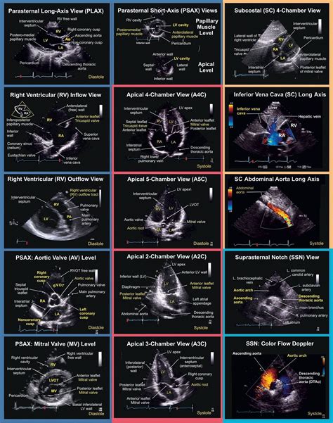 Ultrasound Technician Cardiac Sonography Ultrasound Sonography