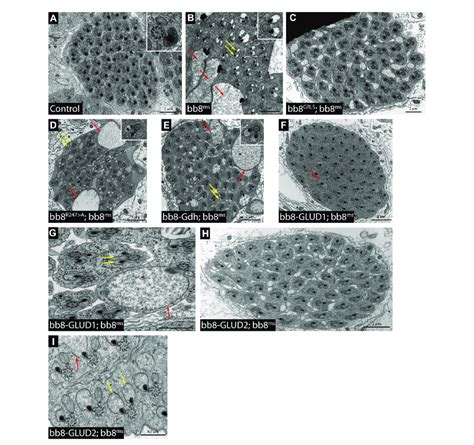 Transmission Electron Micrograms Of Testis Cross Sections Representing