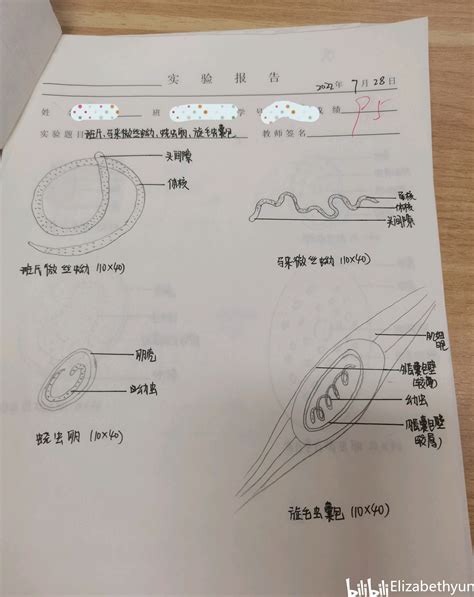 《临床检验寄生虫学》实验手绘图 哔哩哔哩