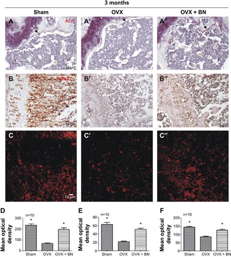 Histochemistry For Alp Immunohistochemistry For Runx2 And