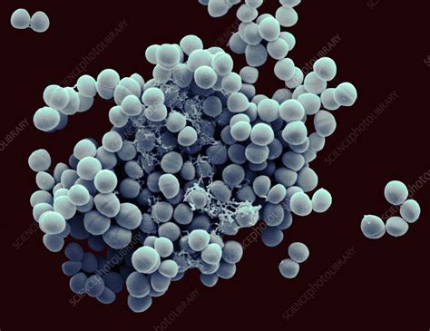 Staphylococcus Epidermidis Stock Image B234 0181 Science Photo Library