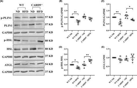 Lipolytic Protein Expression In Pms After 5‐month Hfd Feeding A
