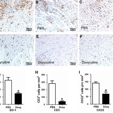 doxycycline suppressed macrophage t cell and b cell infiltration into