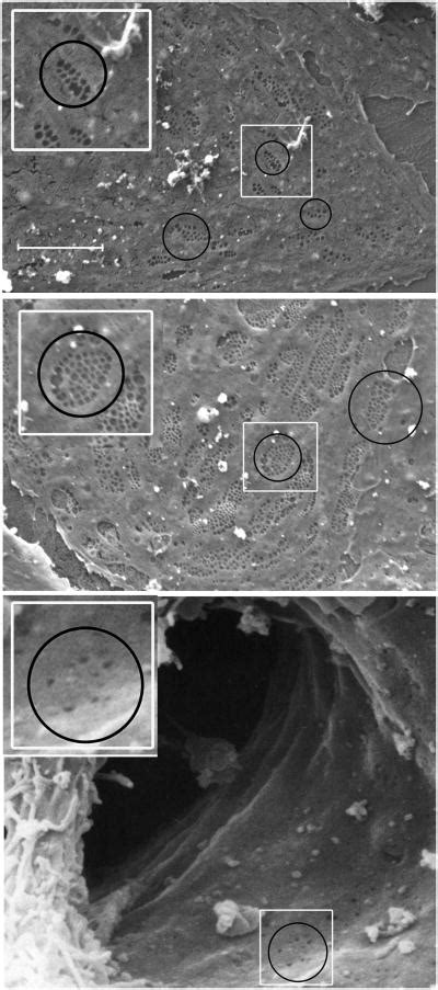 Liver Sinusoidal Endothelial Cells In Hepatic Fibrosis Pmc