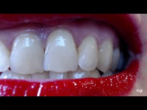 17 Minutes Natural Teeth And Red Lipstick On Lips Wmv Hotkati1