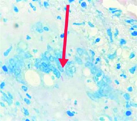 Histopathological Examination Of The Hand Tumor Download Scientific Diagram