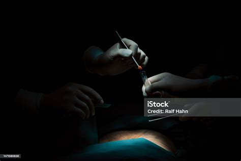 무균 수술실에서 환자에게 수술을 수행하는 근접 수술 팀 3 명에 대한 스톡 사진 및 기타 이미지 3 명 가정의 방 간호사 Istock