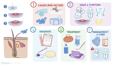 Folliculitis Carbuncles And Furuncles Video Osmosis