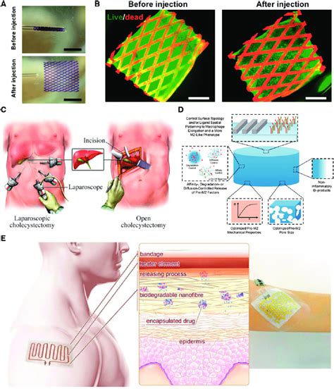 Smart Scaffolds In Tissue Regeneration A Pictures Of Shape Memory