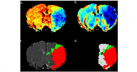 Definitions Of The Ischemic Penumbra Ip Infarct Core Ic And