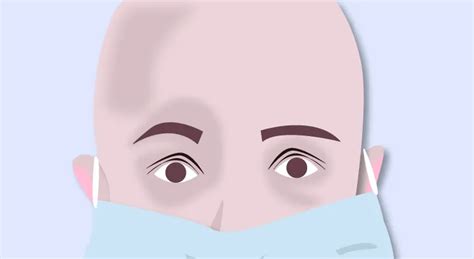 Kanker Leukemia Dan Efek Kemoterapi Yang Membuat Tubuh Tidak Nyaman