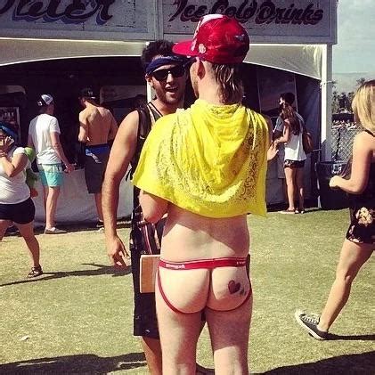 Am I Balding R Hairloss