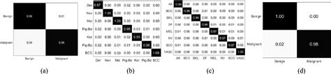 Figure 11 From Deep Semantic Segmentation And Multi Class Skin Lesion Classification Based On