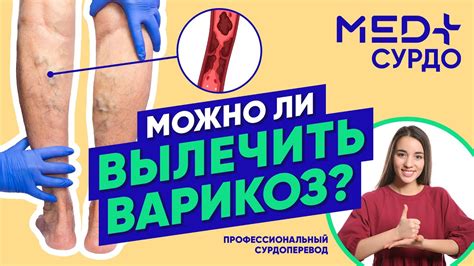 Лечение варикоза на ногах. Сосудистая сетка, тяжесть в ногах: ваши вены ...