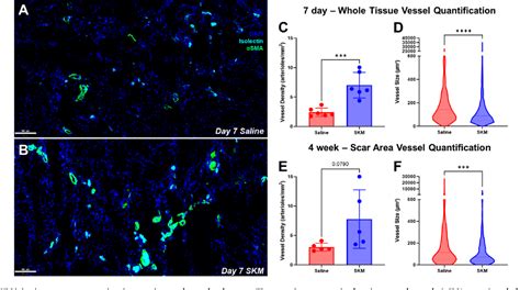 Figure 1 From Immunomodulatory Extracellular Matrix Hydrogel Induces Tissue Regeneration In A