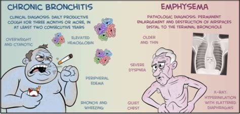 Comprehensive Review Of Respiratory Conditions For Pccn Certification