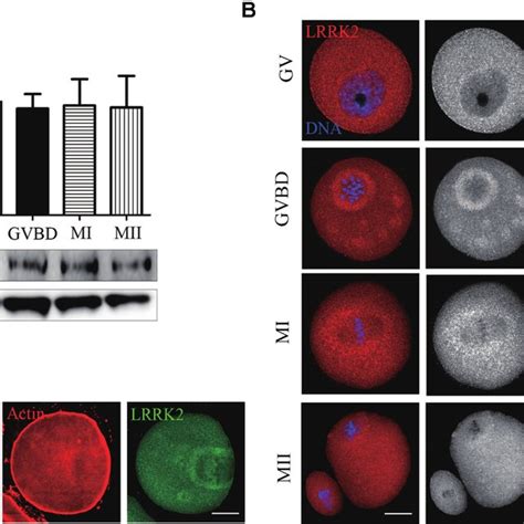 Expression And Localization Of Lrrk2 In Mouse Oocyte Meiosis A The Download Scientific