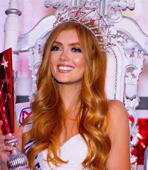 A Lady Was Bullied For Her Looks Now Becomes The First Redhead To Be Crowned Miss England