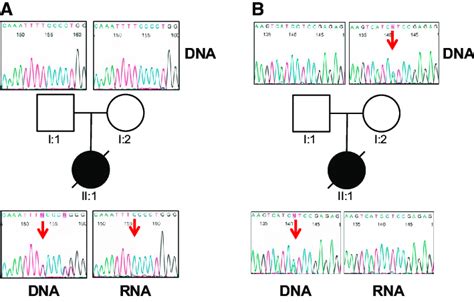 De Novo Truncating Mutation Occurring On The Paternal Magel2 Allele In Download Scientific