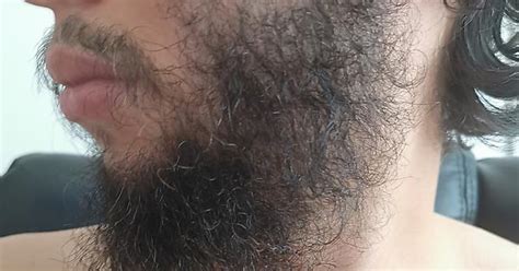 Patchy Af Should I Keep Trim Or Shave Album On Imgur