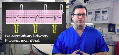 Third Degree Complete Heart Block 12 Lead Ecg Resources Acls Certification Association