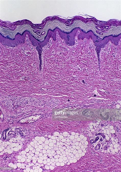 Skin Epidermis Main Structural Features Diagram Quizlet