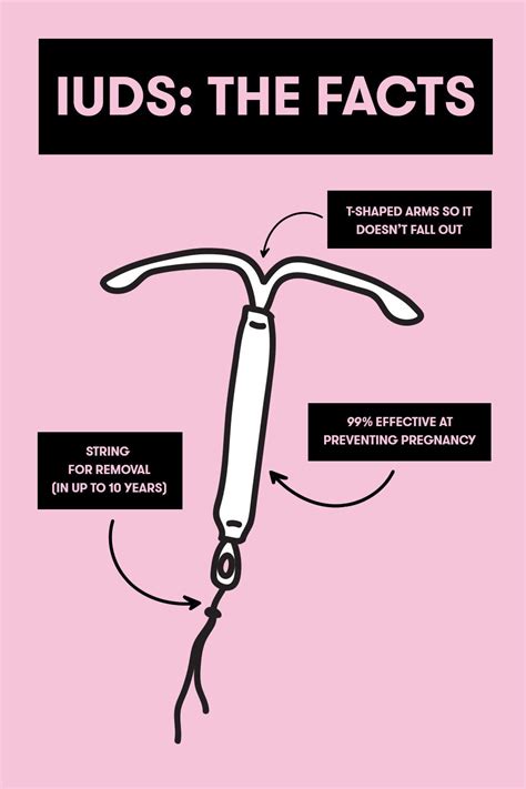 Iud String