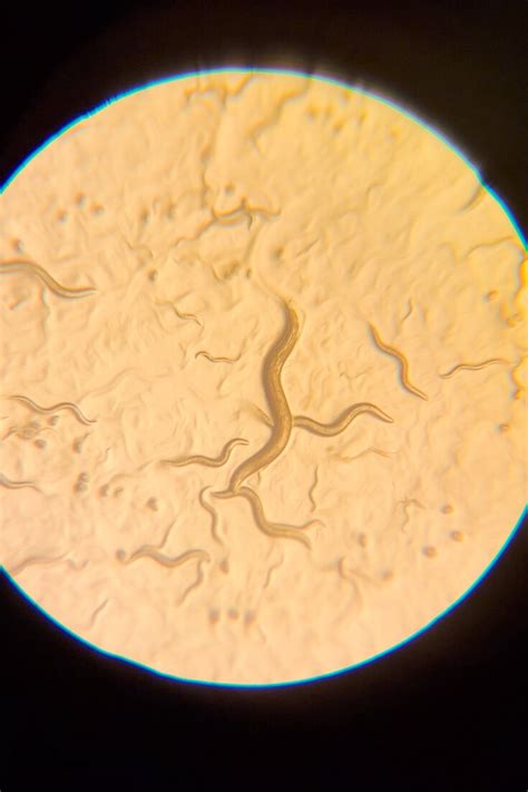 The Miniature Worm That Revolutionized Scientific Research