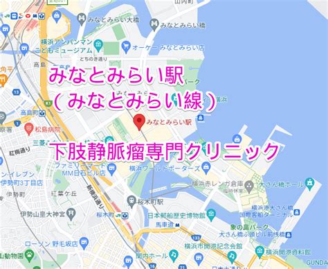 みなとみらい駅周辺の下肢静脈瘤治療の専門医下肢静脈瘤治療手術ができる病院クリニック 下肢静脈瘤の原因症状治療方法予防方法など