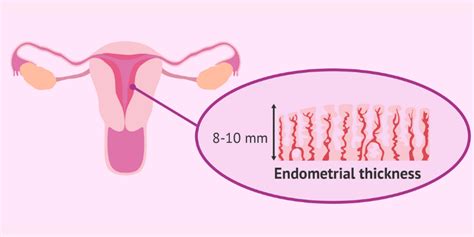 Endometrial Thickness What You Need To Know Oasis Fertility