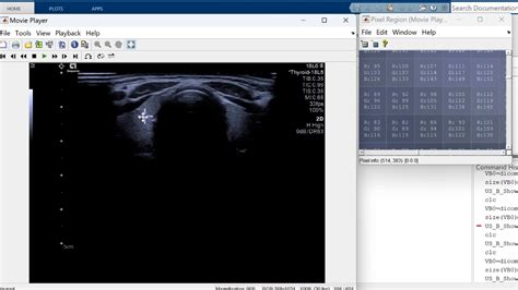 importing and visualizing 4d b mode and color doppler ultrasound data