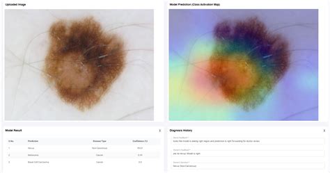 Skin Cancer Detection Web App Using Flask Python And Mysql Wisdom Ml