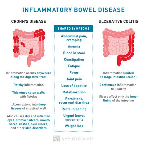 Ulcerative Colitis Autoimmune Functional Medicine Approach To