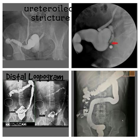 Loopogram A Delhi Radiologic Technologist Group Facebook