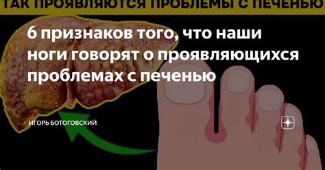 6 признаков того что наши ноги говорят о проявляющихся проблемах с печенью Игорь Ботоговский