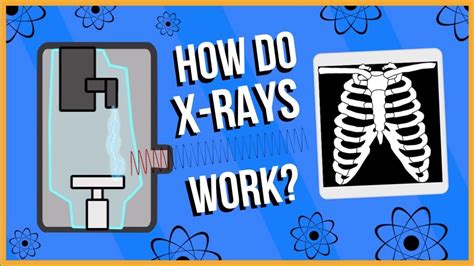 How X Rays Work