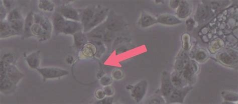 Cell Seeding Protocol Eppendorf Us