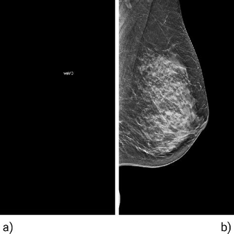 Example Of Imf Feature Classification A Feature Present B Feature