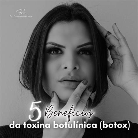 Portal Arcos Você Sabia Que O Botox Possui Inúmeros Benefícios Para A
